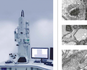An Introduction to Renal Pathology and Electron Microscopy