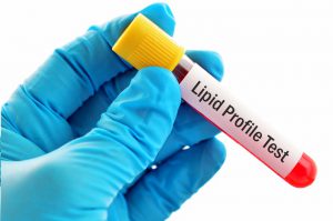An Overview of Lipid Profile Test and it's Components