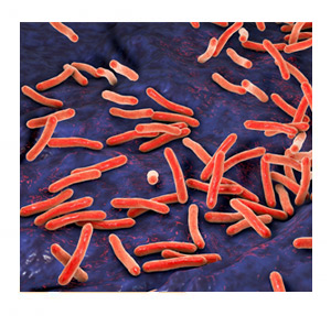 What doctors need to know about curing Tuberculosis