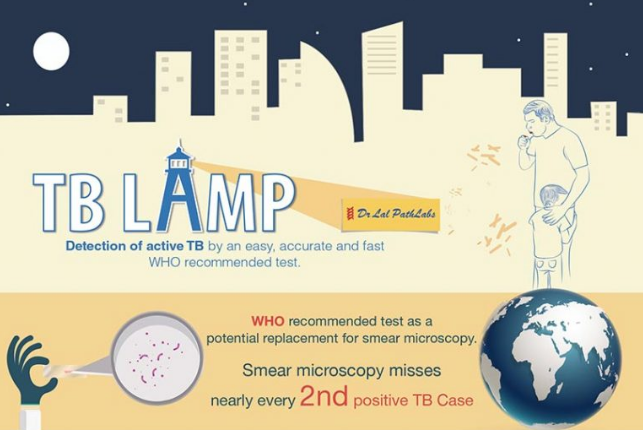 TB-Lamp Detection of Active TB by an Easy, Accurate and Fast Who ...