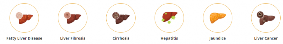Liver Disease: Common Symptoms, Diagnosis, Screening & Treatment