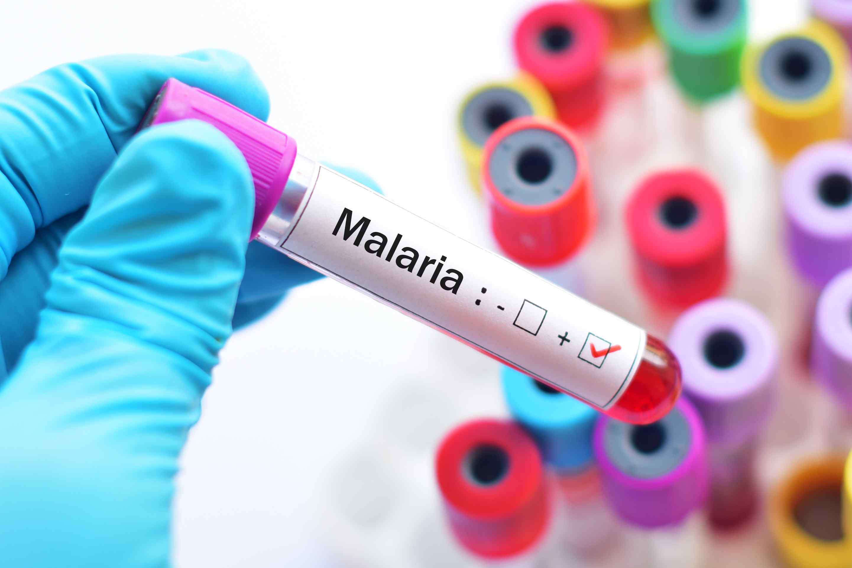 Overview of Malaria: Symptoms, Complications and Diagnosis