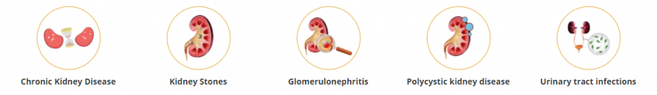 Kidney Disease: Symptoms, Types and Treatment