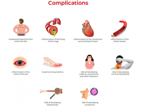 Rheumatoid Arthritis – Causes, Symptoms, Diagnosis & Treatment | Lal PathLabs