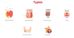 Thyroid Problem – Types, Causes, Symptoms & Diagnosis | Lal PathLabs