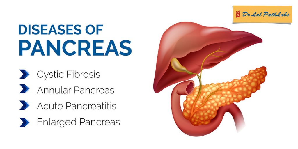 Pancreas: Functions, Diseases and Diagnosis | Dr. Lal PathLabs