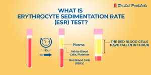 Understanding ESR Test and Erythrocyte Sedimentation Rate | Dr. Lal ...