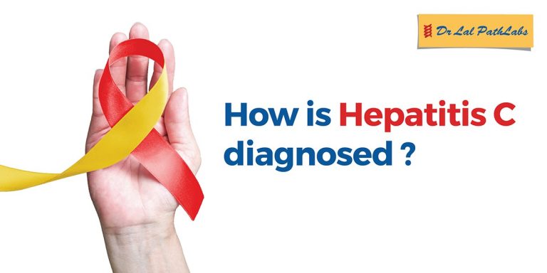Hepatitis C: What It Is, Symptoms & Diagnosis | Dr. Lal PathLabs