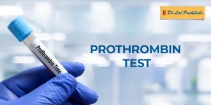 Accurate Prothrombin Time Test and PT INR Measurement | Dr. Lal PathLabs