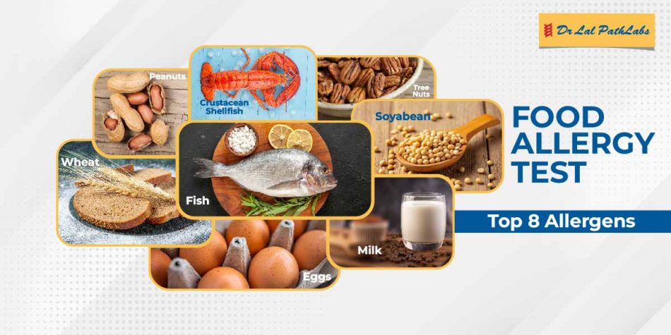 Food Allergy: Causes, Symptoms and Diagnosis | Dr. Lal PathLabs