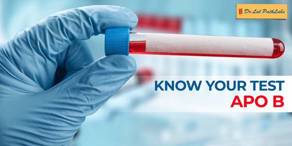 Dr Lal PathLabs Blog