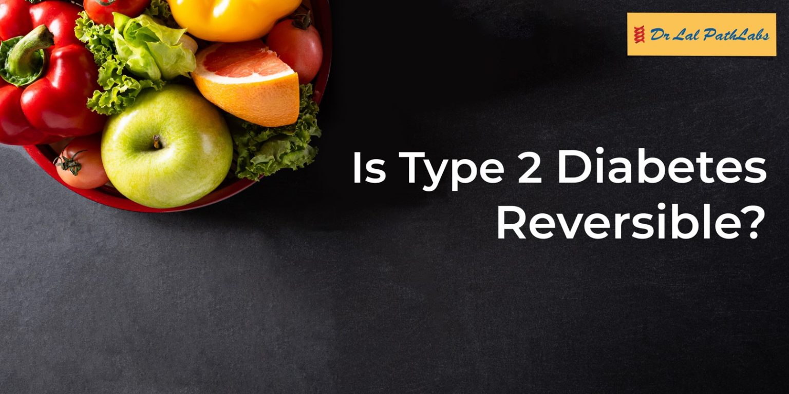 What is Type 2 Diabetes - Is Type 2 Diabetes Reversible | Dr Lal ...